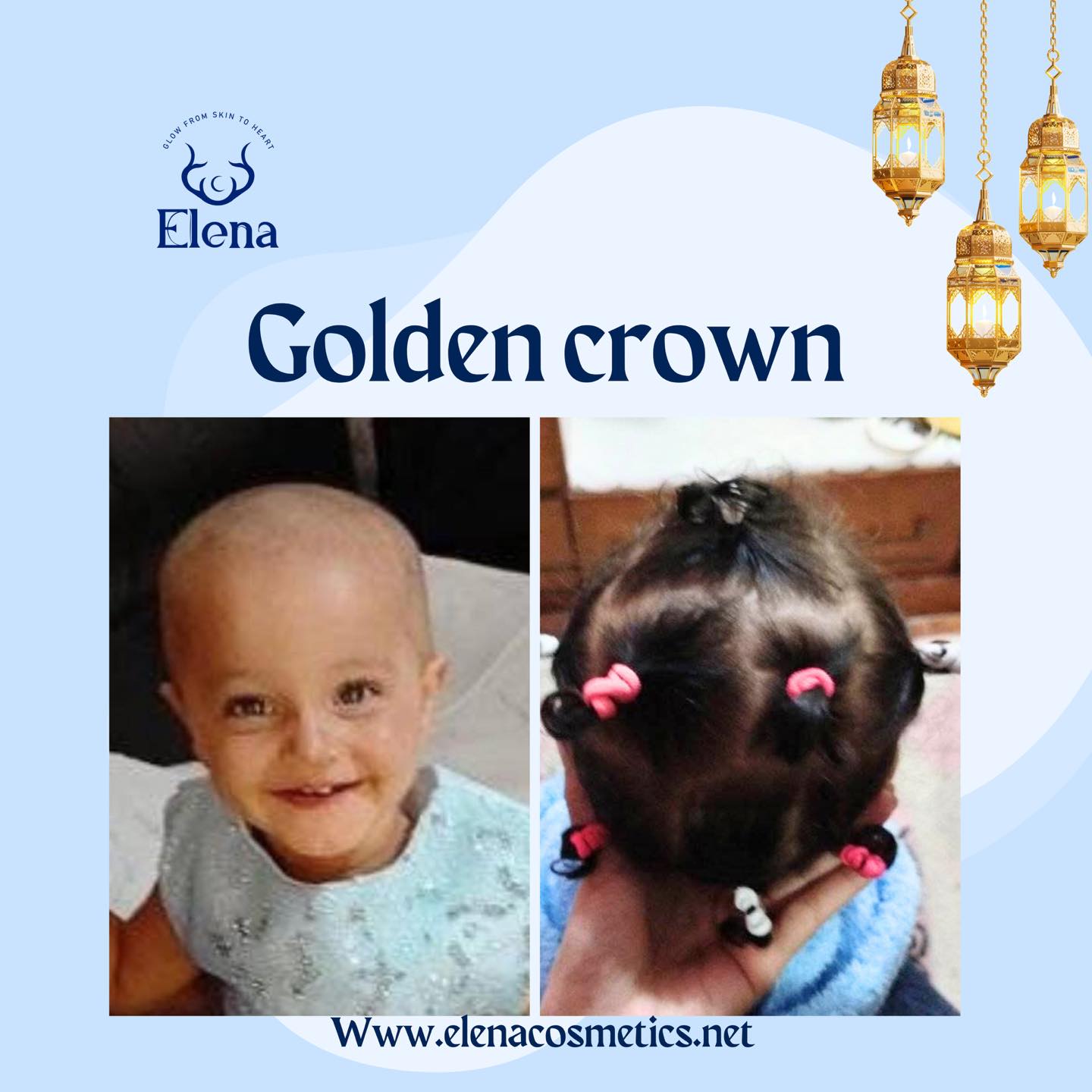 Golden Crown Oil for Hair Growth & Root Strengthening | Elena Cosmetic